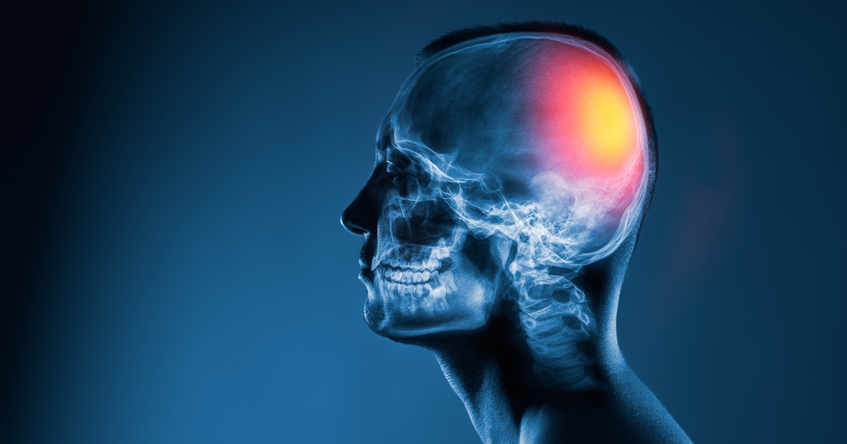 Brain Stem Injury From a South Bend Crash – What To Do?